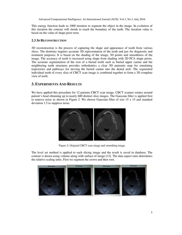 Study Analysis on Teeth Segmentation Using Level Set Method | PDF
