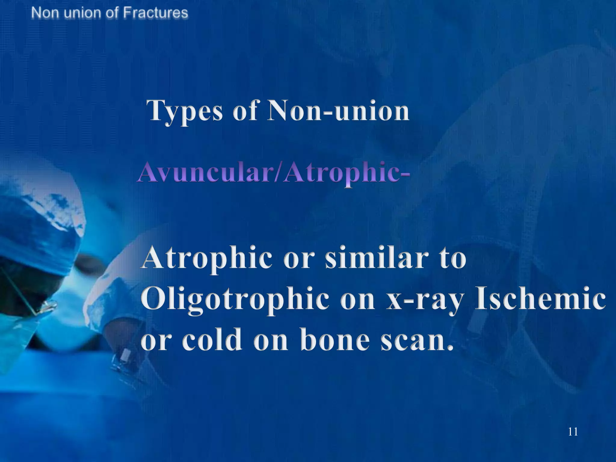 bone-fractures-nonunion-diagnosis-and-management-at-shaheed-suhrawardy ...