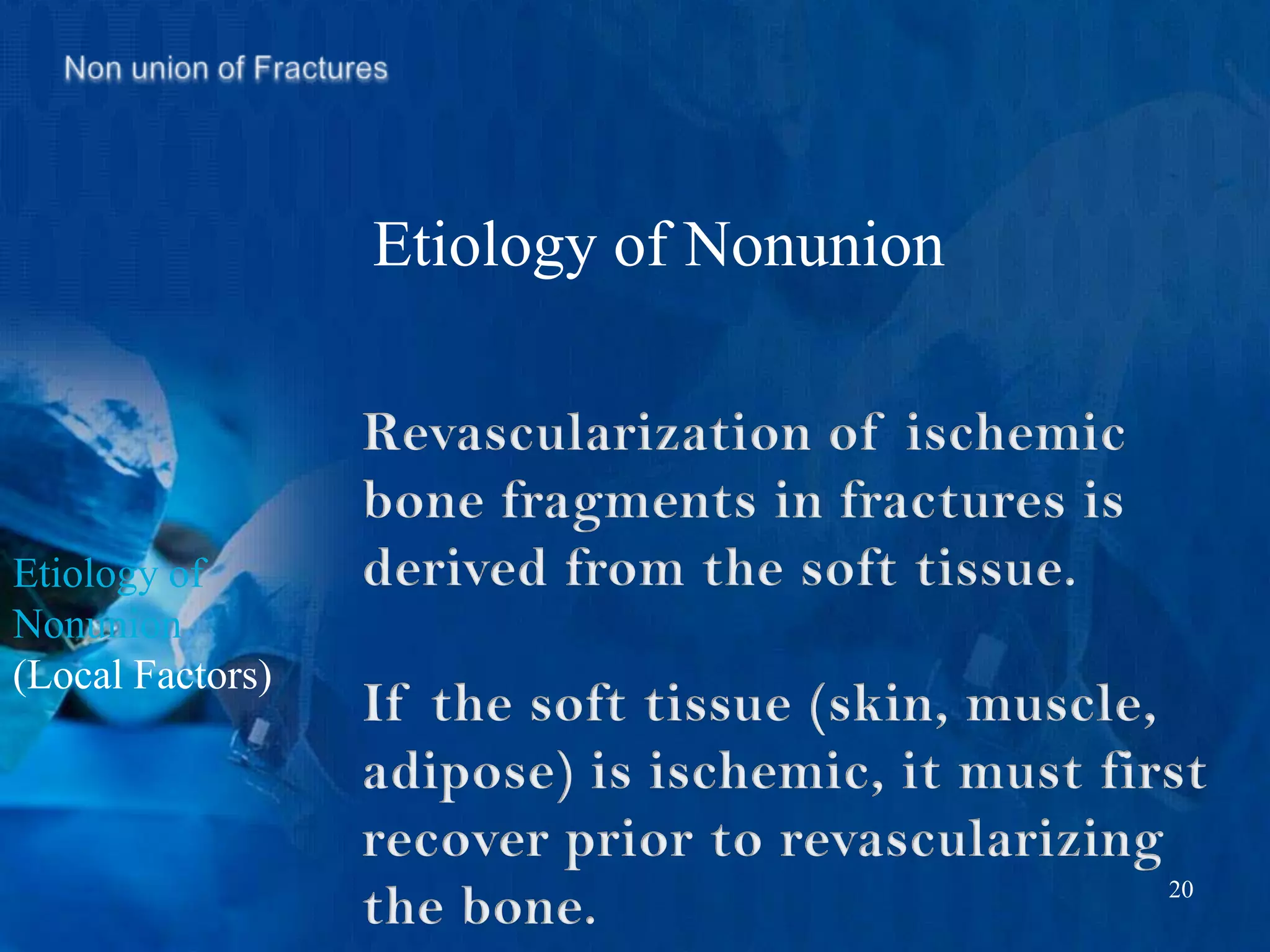 bone-fractures-nonunion-diagnosis-and-management-at-shaheed-suhrawardy ...