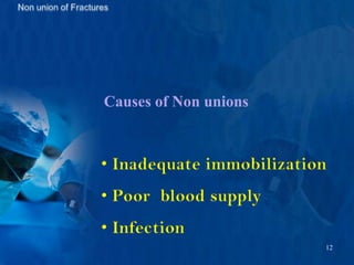 bone-fractures-nonunion-diagnosis-and-management-at-shaheed-suhrawardy ...