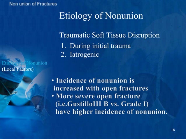 bone-fractures-nonunion-diagnosis-and-management-at-shaheed-suhrawardy ...