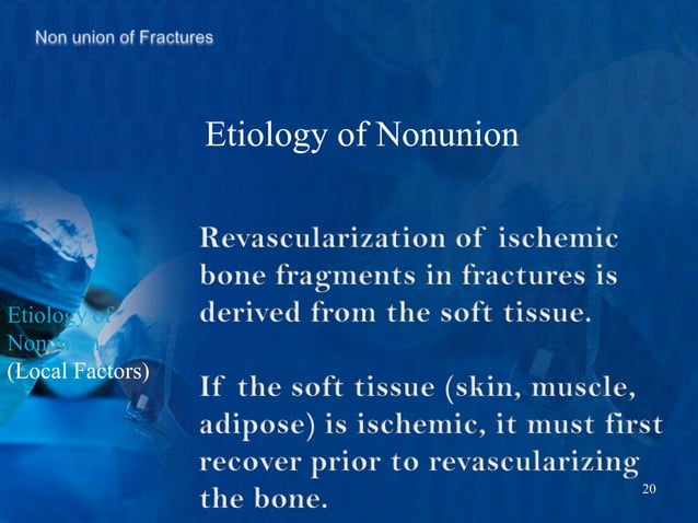 bone-fractures-nonunion-diagnosis-and-management-at-shaheed-suhrawardy ...