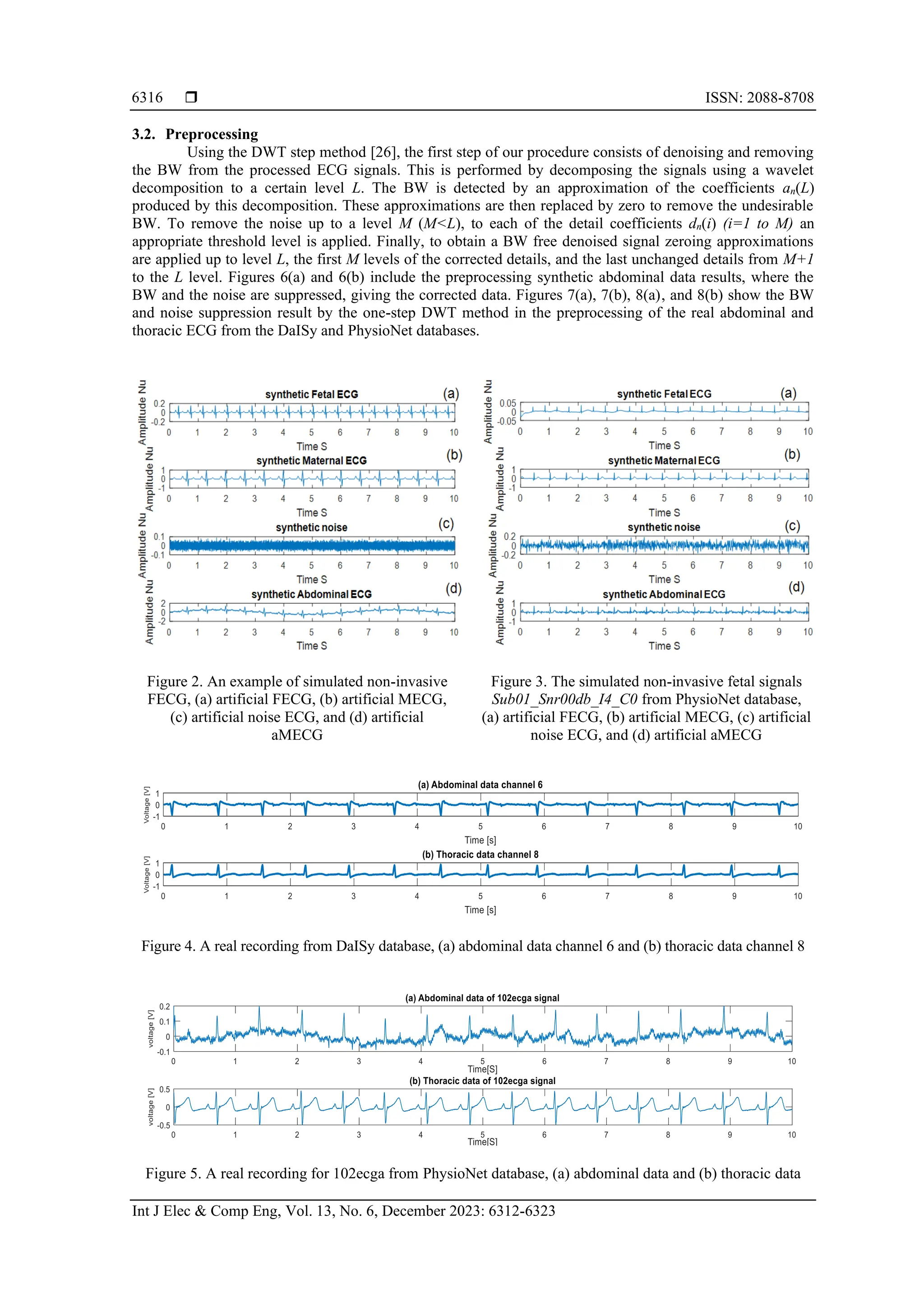 Generalized recursive algorithm for fetal electrocardiogram isolation ...