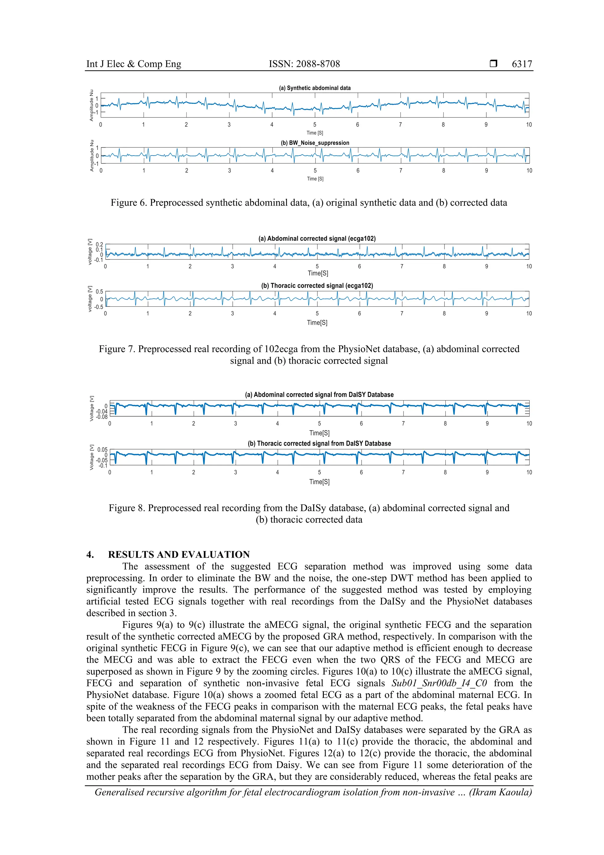 Generalized recursive algorithm for fetal electrocardiogram isolation from non-invasive maternal ...