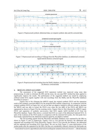 Generalized recursive algorithm for fetal electrocardiogram isolation from non-invasive maternal ...