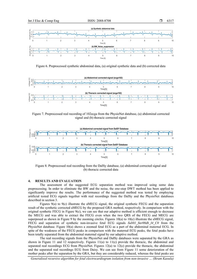Generalized recursive algorithm for fetal electrocardiogram isolation from non-invasive maternal ...
