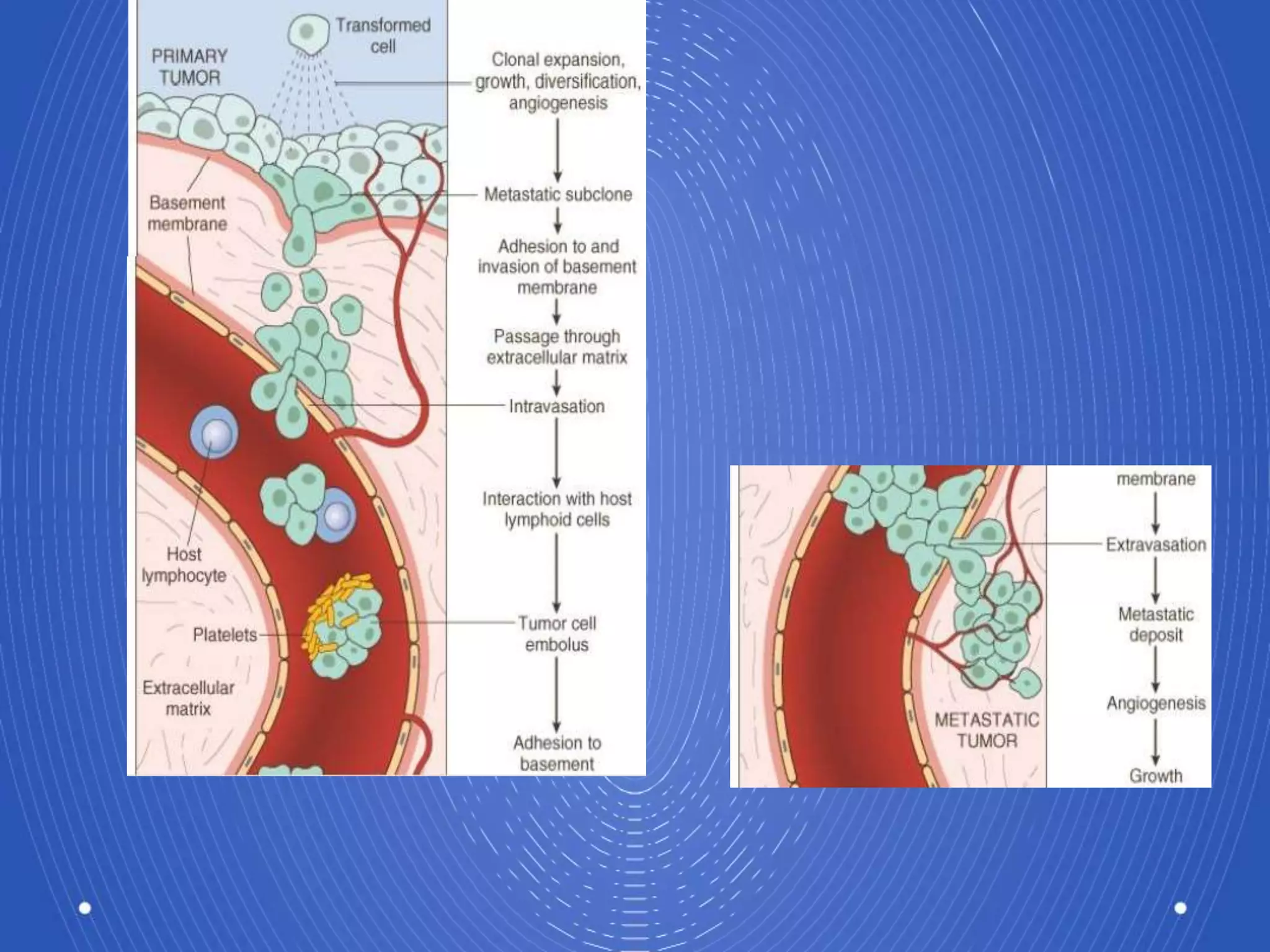334269046-Routes-Mechanisms-of-Metastasis (1).docx