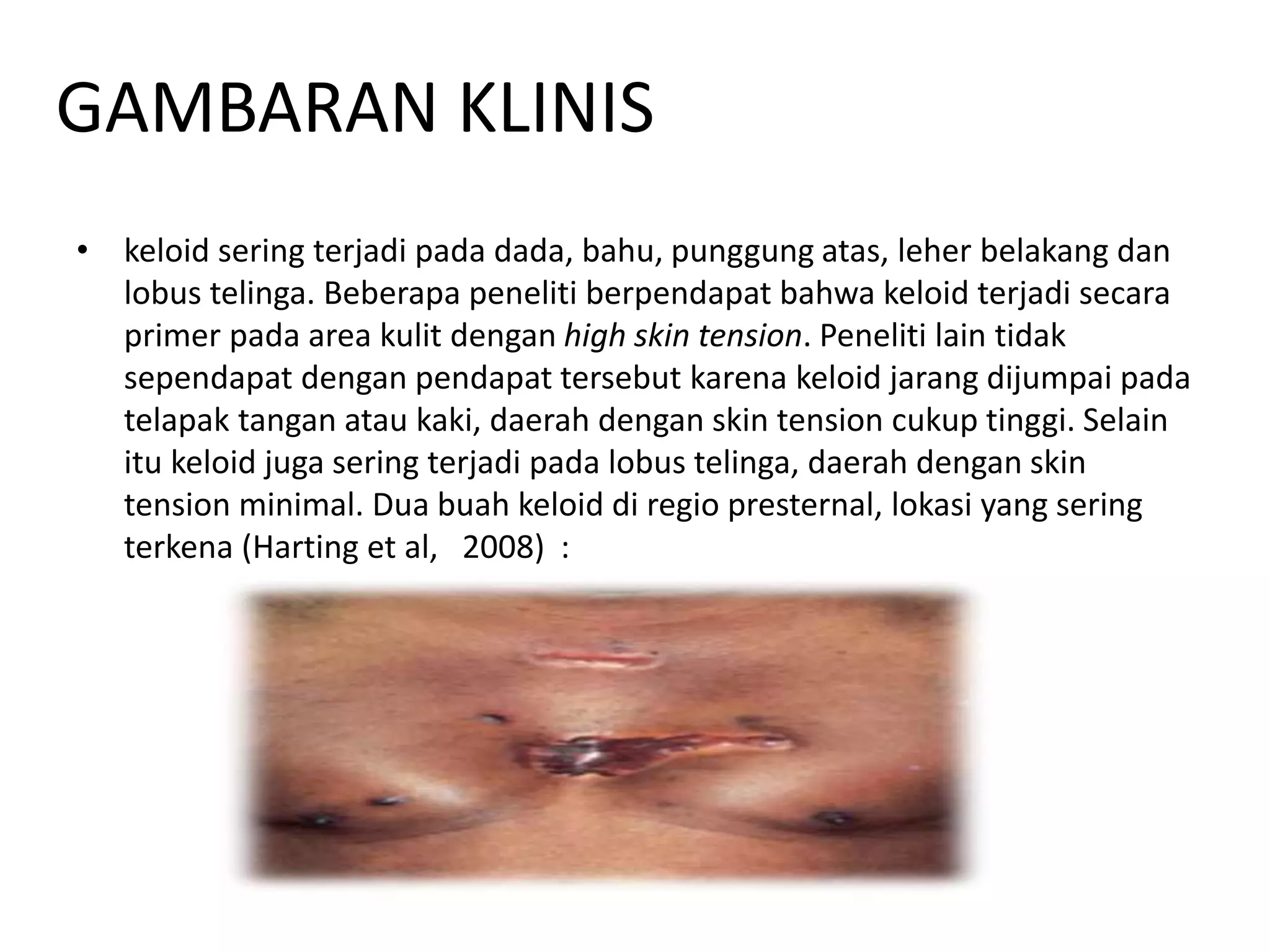 334652085-Ppt-Keloid.pptx