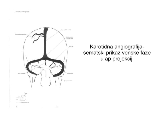 336050534-Radiološka-anatomija.ppt