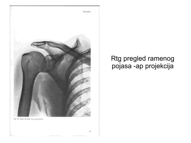 336050534-Radiološka-anatomija.ppt