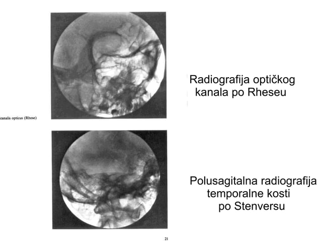 336050534-Radiološka-anatomija.ppt