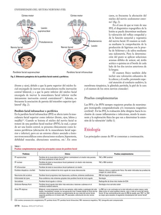 337 Dx afectacion nervio facial (exp clinic) | PDF