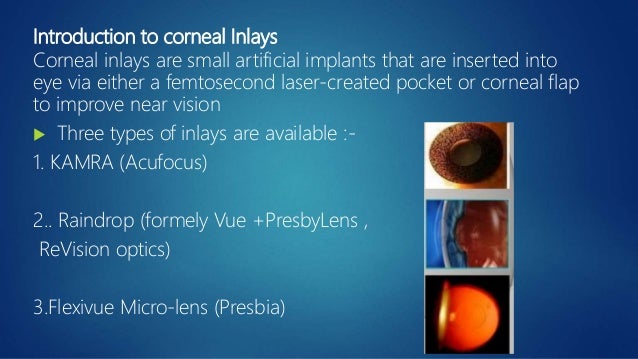 Intra Corneal Inlays For Presbyopic Correction