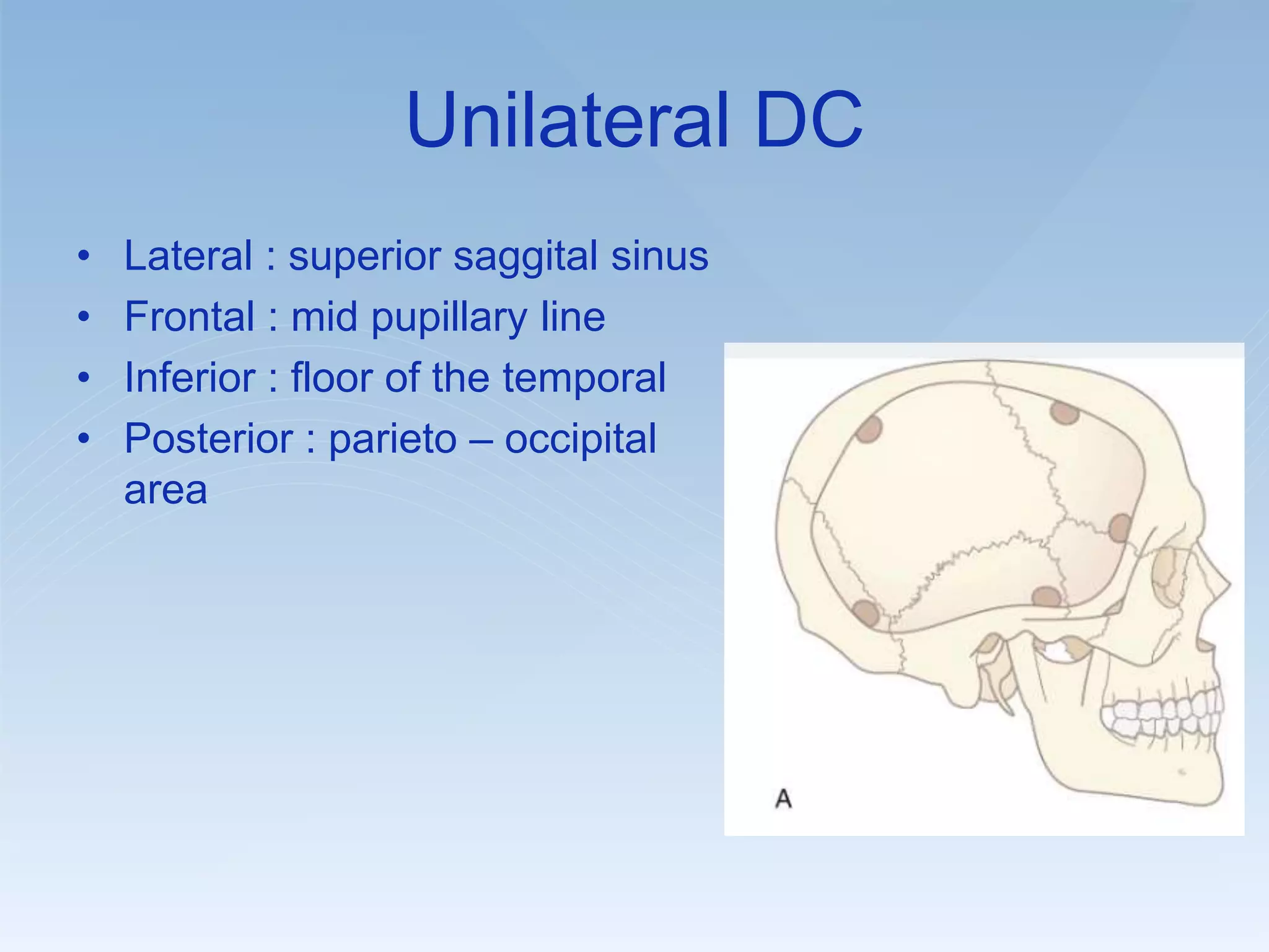 338 Indications and technique for cranial decompression after traumatic ...