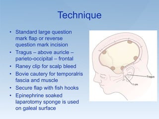 338 Indications and technique for cranial decompression after traumatic ...