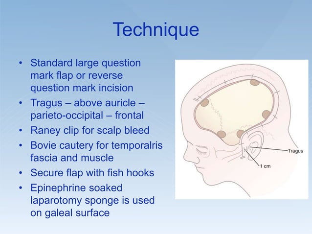 338 Indications and technique for cranial decompression after traumatic ...