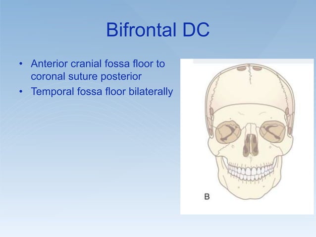 338 Indications and technique for cranial decompression after traumatic ...