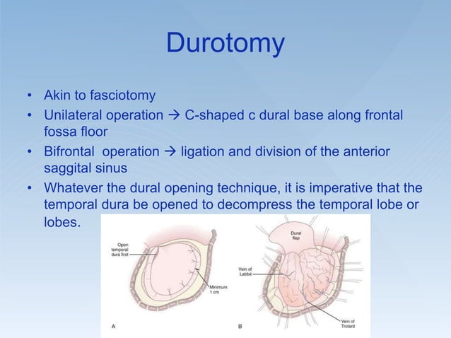 338 Indications and technique for cranial decompression after traumatic ...