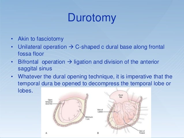 338 Indications and technique for cranial decompression after traumat…