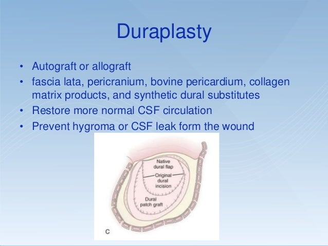 338 Indications and technique for cranial decompression after traumat…