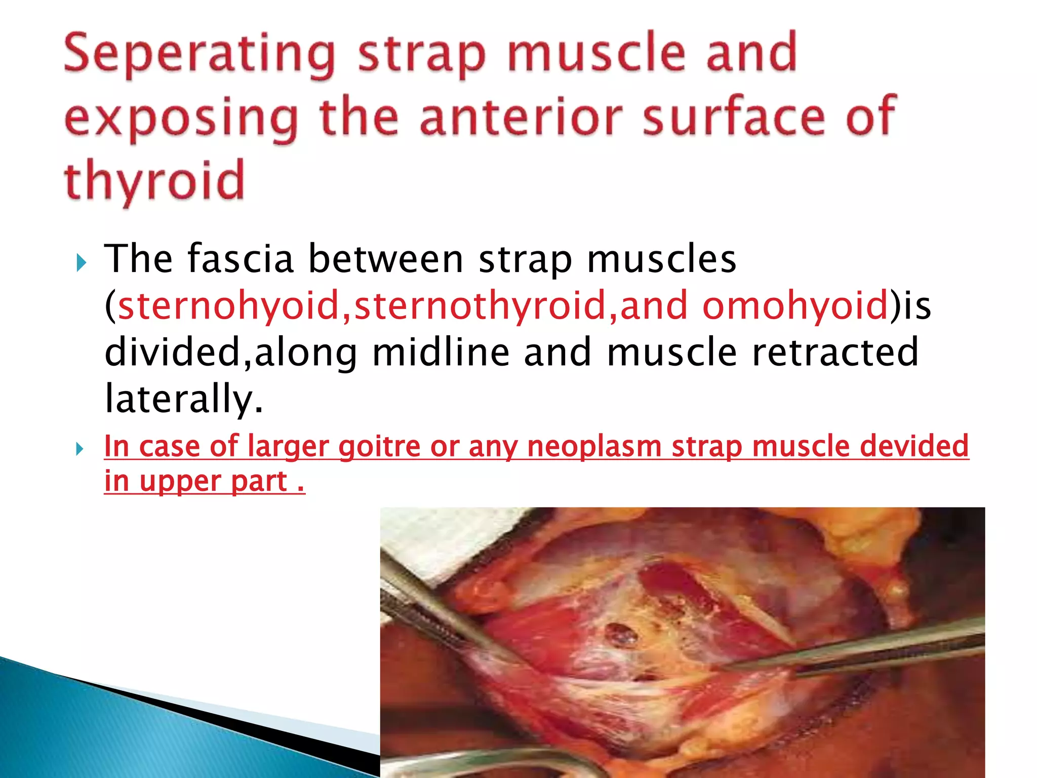 thyroid surgery important | PPTX