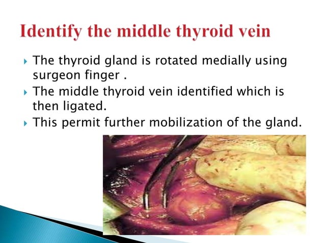 thyroid surgery important | PPTX