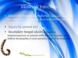 Fungal corneal ulcer 3rd yr | PPTX