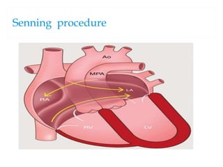 congenital Heart Defects.PDA,ASD,VSD,TGApptx | PPTX