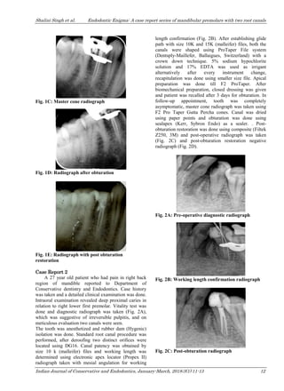 33rd publication ijce - 5th name | PDF | Dental Health | Diseases and ...