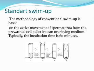 Copy_of_IUI_Sample_Prep.pptx | Infertility | Reproductive Health