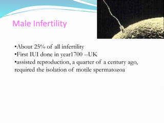 Copy_of_IUI_Sample_Prep.pptx | Infertility | Reproductive Health
