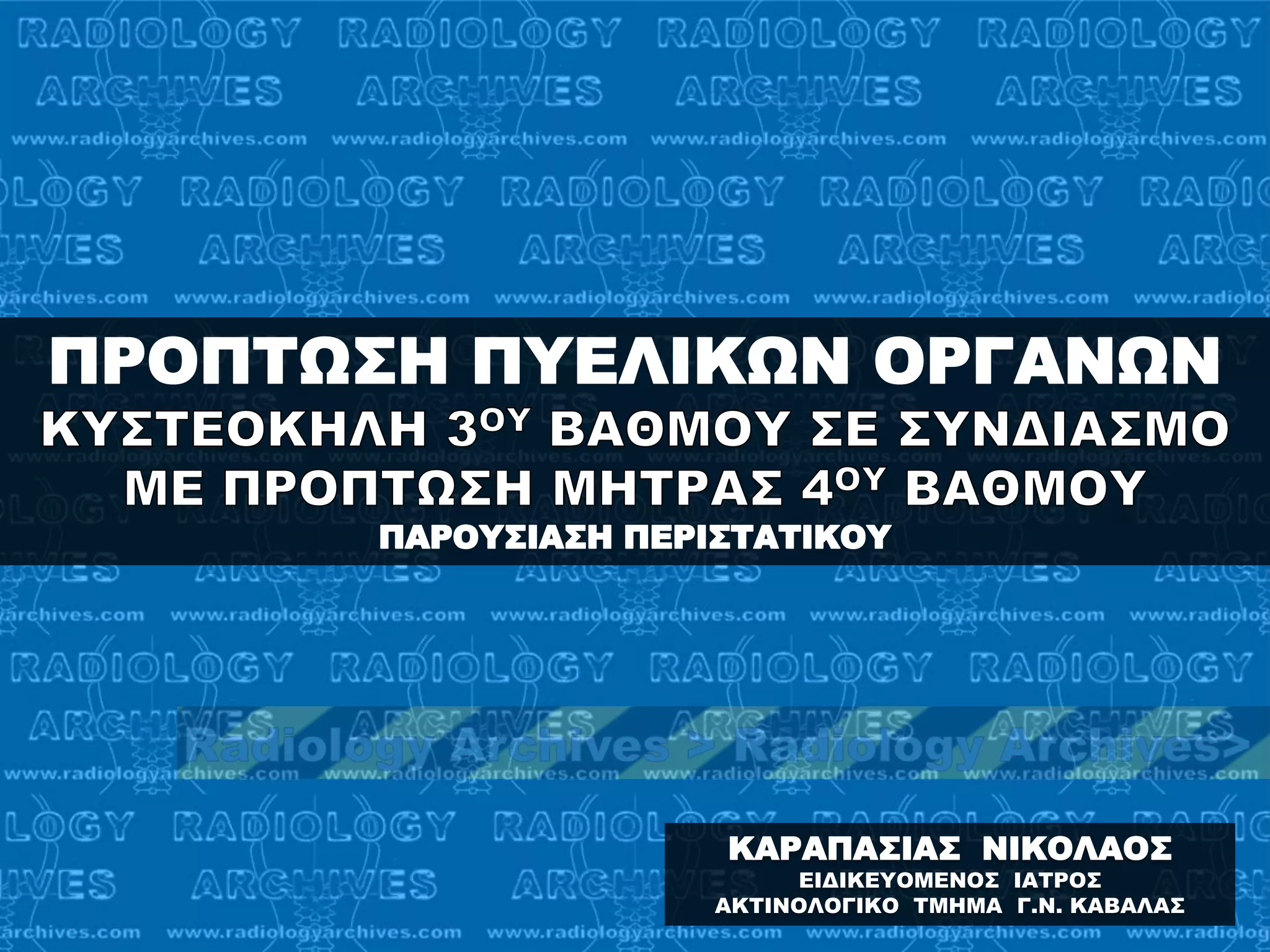 Κυστεοκήλη 3ου Βαθμού σε Συνδιασμό με Πρόπτωση Μήτρας 4ου Βαθμού | PPT