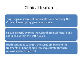 34.eruption sequestrum | PPT