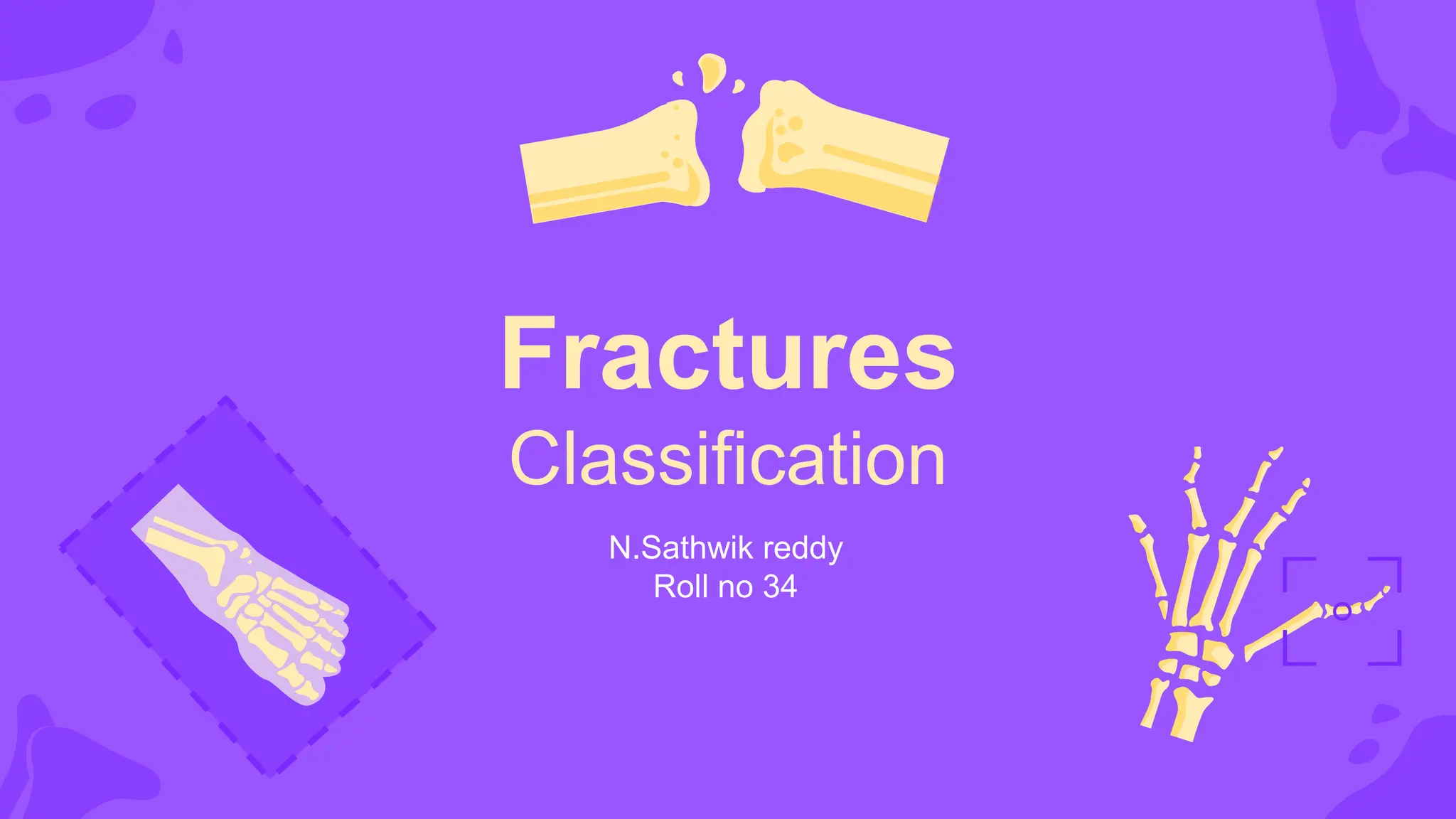 FRACTURES.power point presentation - NSR | PPT