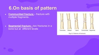 FRACTURES.power point presentation - NSR | PPT