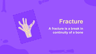 FRACTURES.power point presentation - NSR | PPT