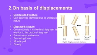 FRACTURES.power point presentation - NSR | PPT