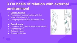 FRACTURES.power point presentation - NSR | PPT