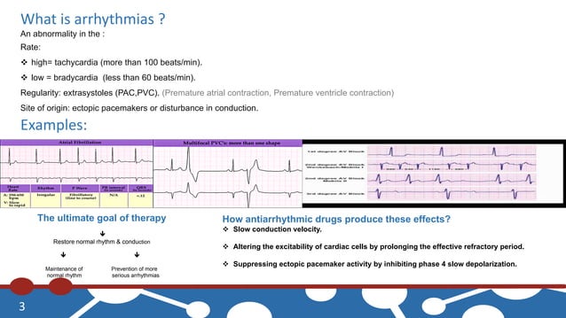 3,4- Anti-arrhythmic drugs.pdf pharmacology | PDF | Heart and ...