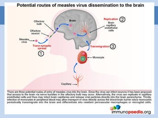 CAMPAk measles morbili patogenesis .pptx