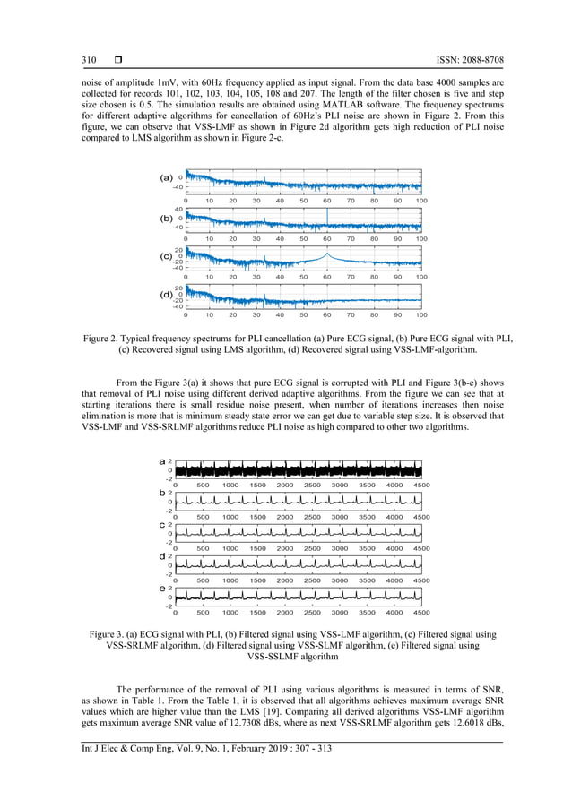 Efficient Reduction Of Pli In Ecg Signal Using New Variable Step Size Least Mean Fourth Adaptive