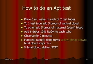 Ante Partum Hemorrhage.ppt