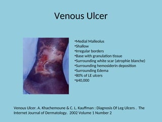 chronic venous insufficiency definition etiology | PPT