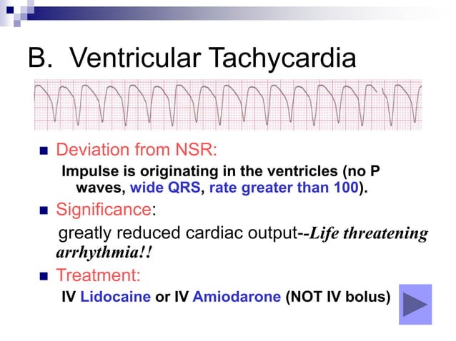 ECG basics ppt | PPT