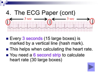 ECG basics ppt | PPT