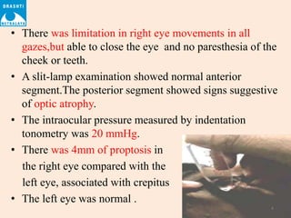 Tension Pneumo-Orbit:A Rare Tension | PPTX