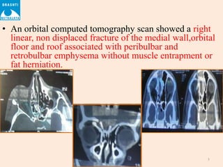 Tension Pneumo-Orbit:A Rare Tension | PPTX | Death, Injury, or Military ...