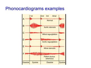 347_heart_sounds_&_murmurs.ppt