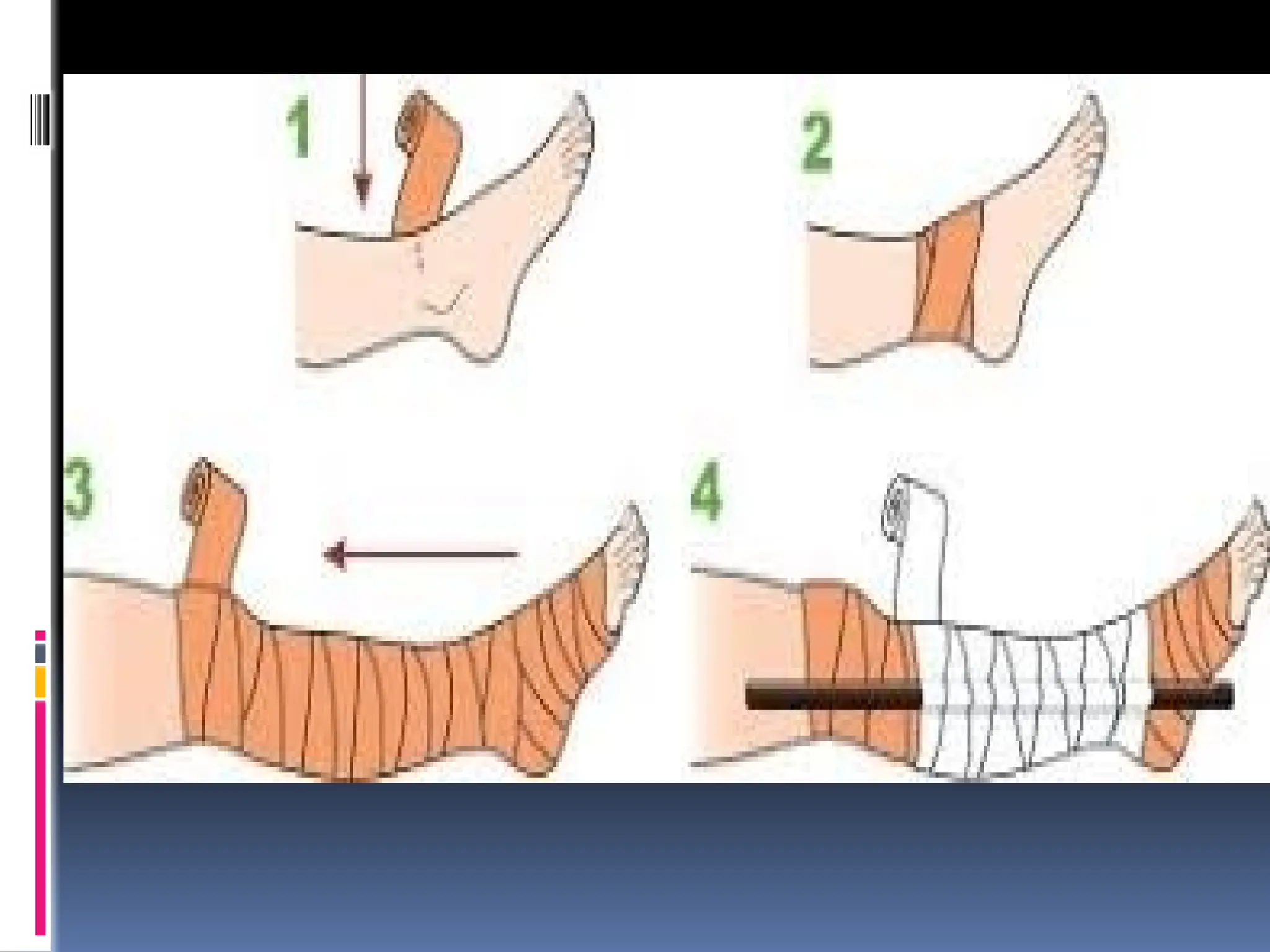 Snake Bite first aid and procedures folllow.pptx