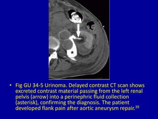 34 perinephric mass on computed tomography and magnetic | PPTX